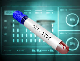 Rising STI infections and repeat cases raise alarm in Bulawayo – CITEZW